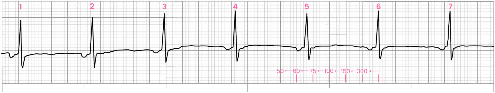 Heart Rate Practice Exercise - SkillStat