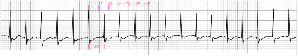 Heart Rate Practice Exercise - SkillStat