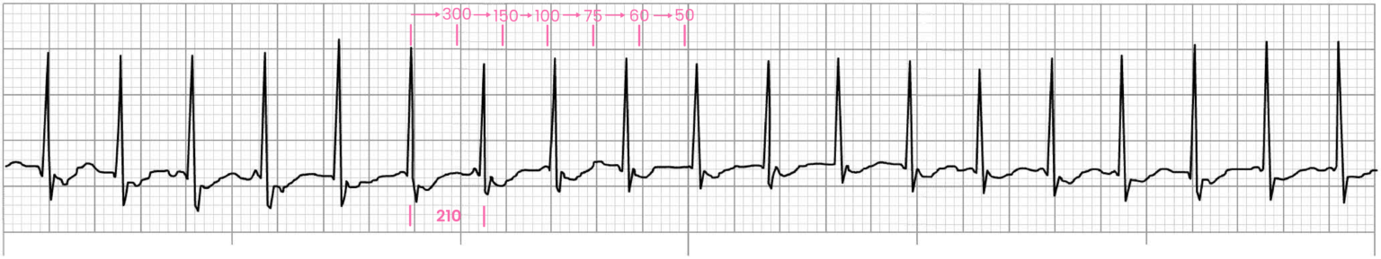 Heart Rate Practice Exercise - SkillStat
