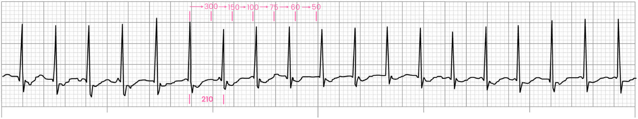Heart Rate Practice Exercise - SkillStat