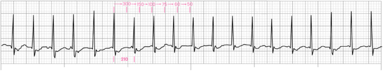 Heart Rate Practice Exercise - SkillStat