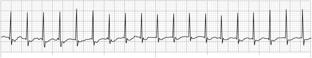 Heart Rate Practice Exercise - SkillStat