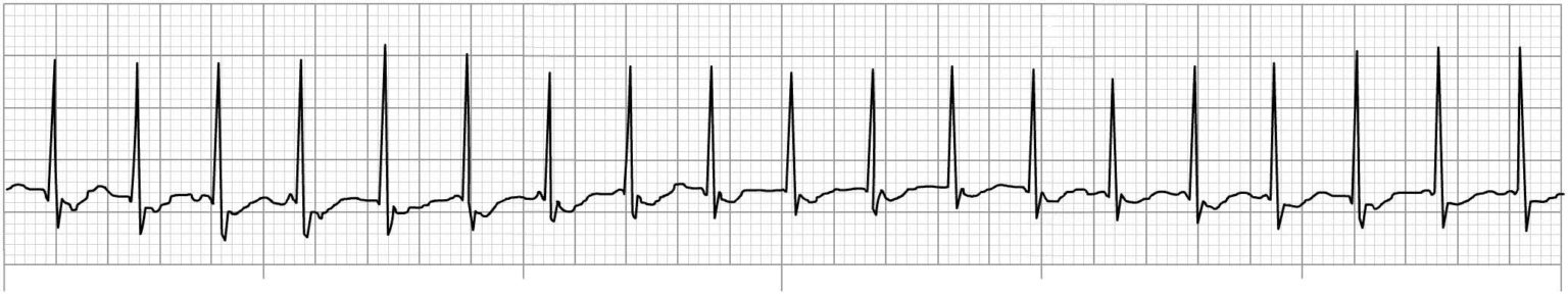 Heart Rate Practice Exercise - SkillStat