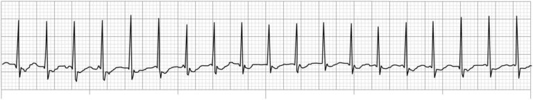 Heart Rate Practice Exercise - SkillStat