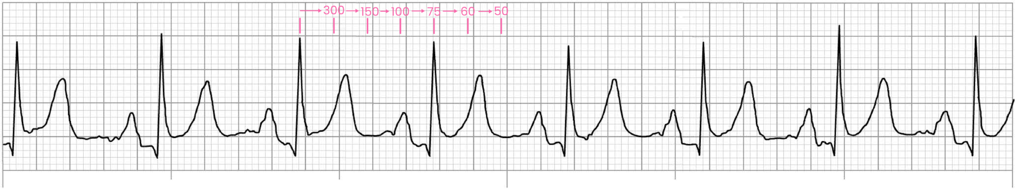 Heart Rate Practice Exercise - SkillStat