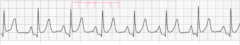 Heart Rate Practice Exercise - SkillStat