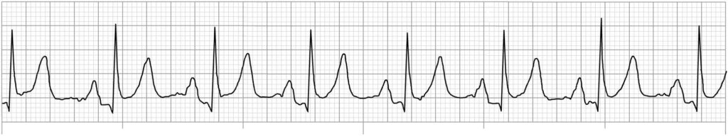 Heart Rate Practice Exercise - SkillStat