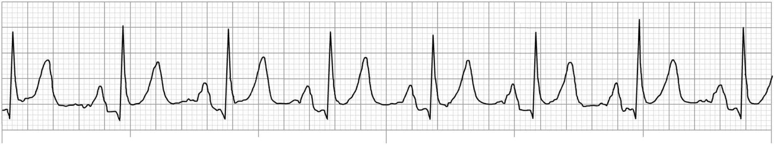 Heart Rate Practice Exercise - SkillStat
