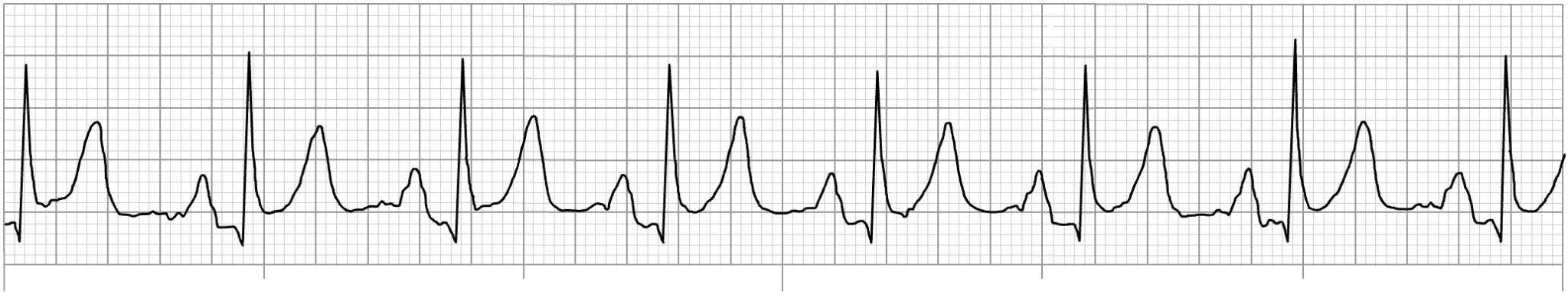 Heart Rate Practice Exercise - SkillStat