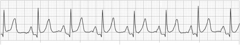 Heart Rate Practice Exercise - SkillStat