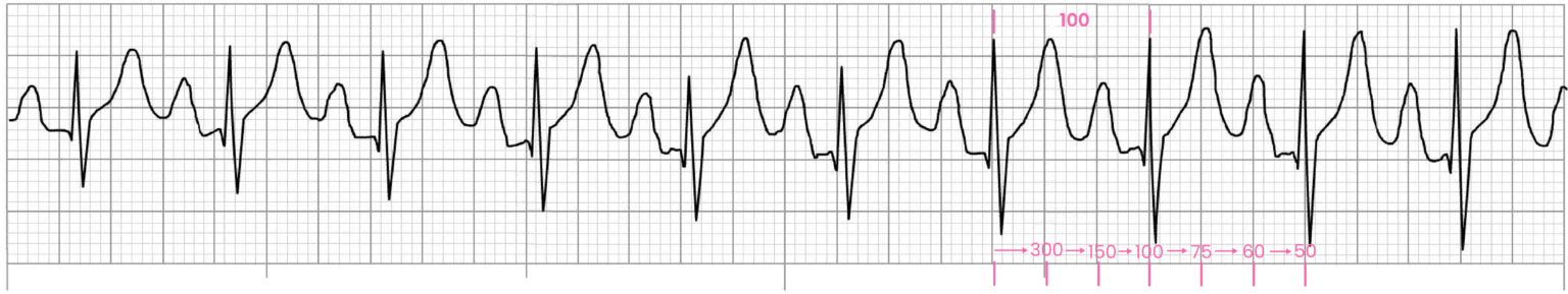 Heart Rate Practice Exercise - SkillStat
