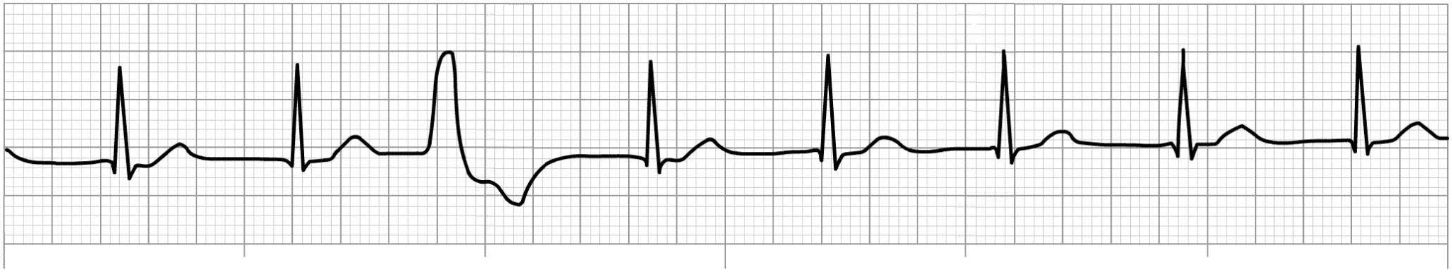 Heart Rate Practice Exercise - SkillStat