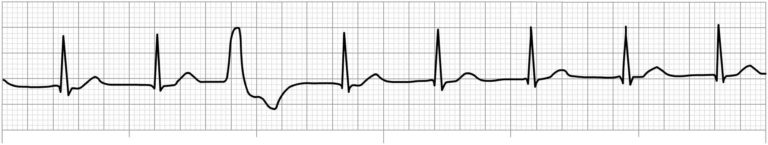 Heart Rate Practice Exercise - SkillStat
