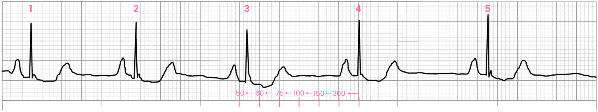 Heart Rate Practice Exercise - SkillStat
