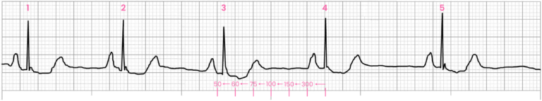Heart Rate Practice Exercise - SkillStat