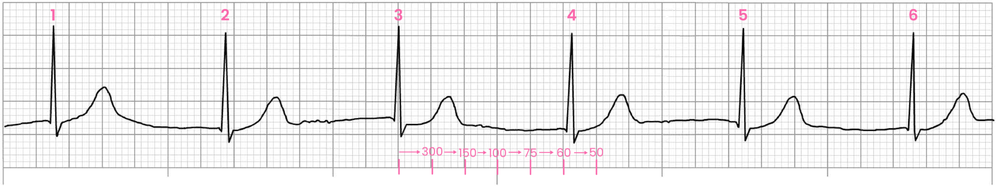 Heart Rate Practice Exercise - SkillStat