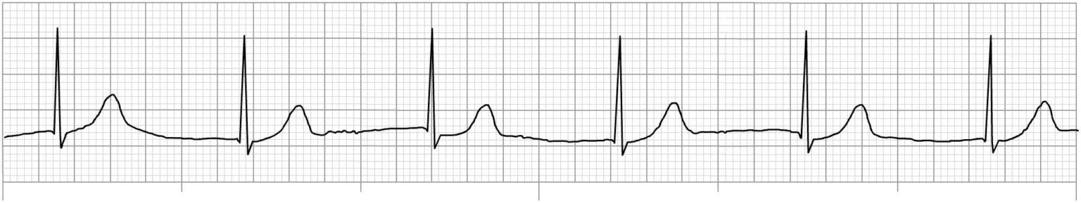 Heart Rate Practice Exercise - SkillStat