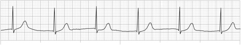 Heart Rate Practice Exercise - SkillStat