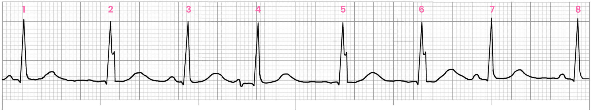 Heart Rate Practice Exercise - SkillStat