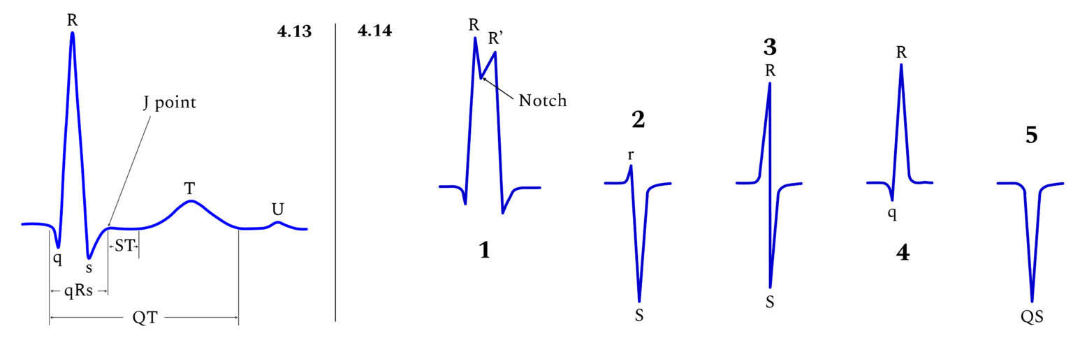 QRS Complex | SkillStat