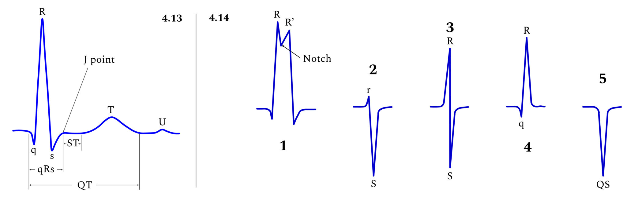 QRS Complex | SkillStat
