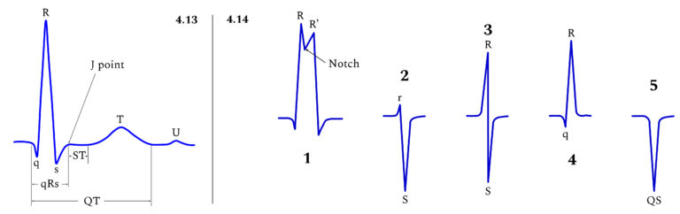 QRS Complex - SkillStat