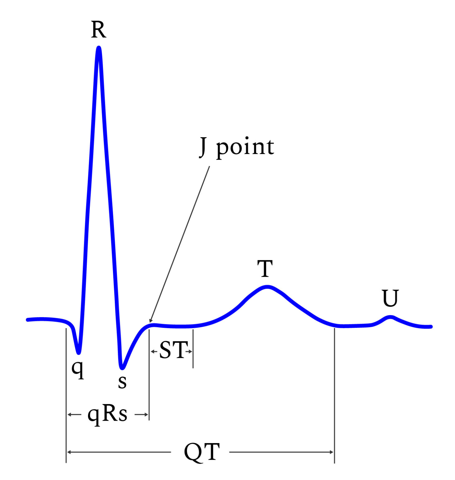 Ventricular Repolarization - SkillStat